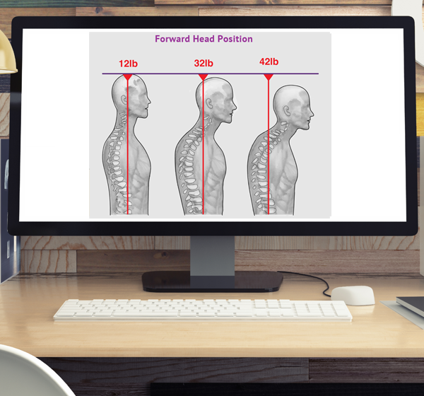 Posture management training